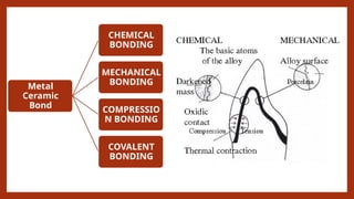 Dental Ceramics Part II - Dental Materials | PPT
