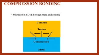 Dental Ceramics Part II - Dental Materials | PPT