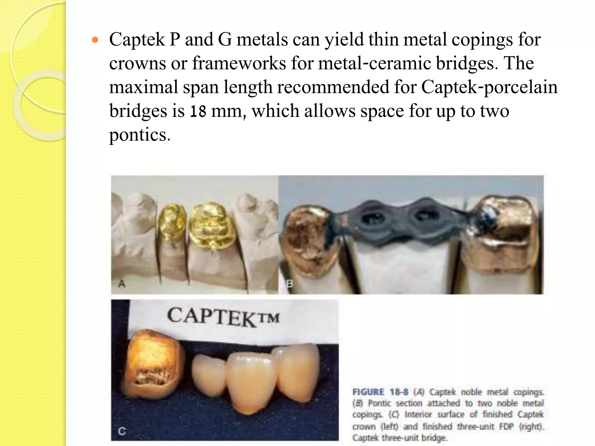Dental ceramics | PPTX