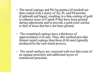 Dental ceramics | PPTX