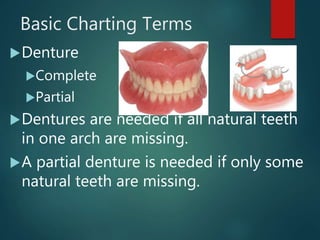 Dental charting, Cavity Classification, Basic Charting Terms | PPTX