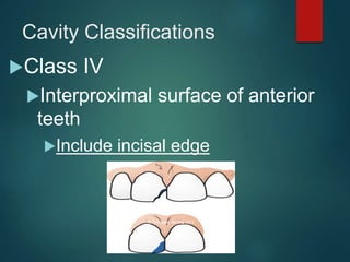 Dental charting, Cavity Classification, Basic Charting Terms | PPTX