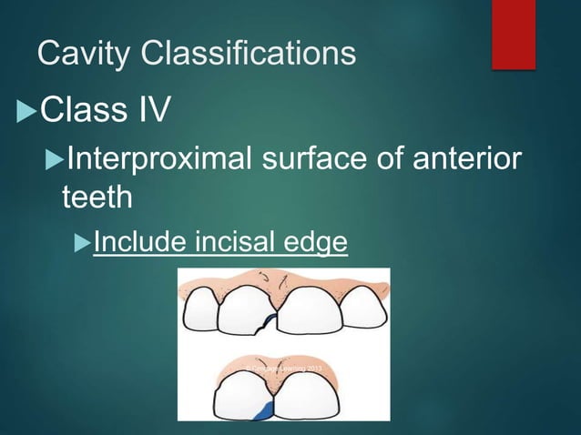 Dental charting, Cavity Classification, Basic Charting Terms | PPTX ...