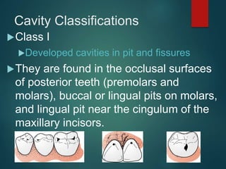 Dental charting, Cavity Classification, Basic Charting Terms | PPT