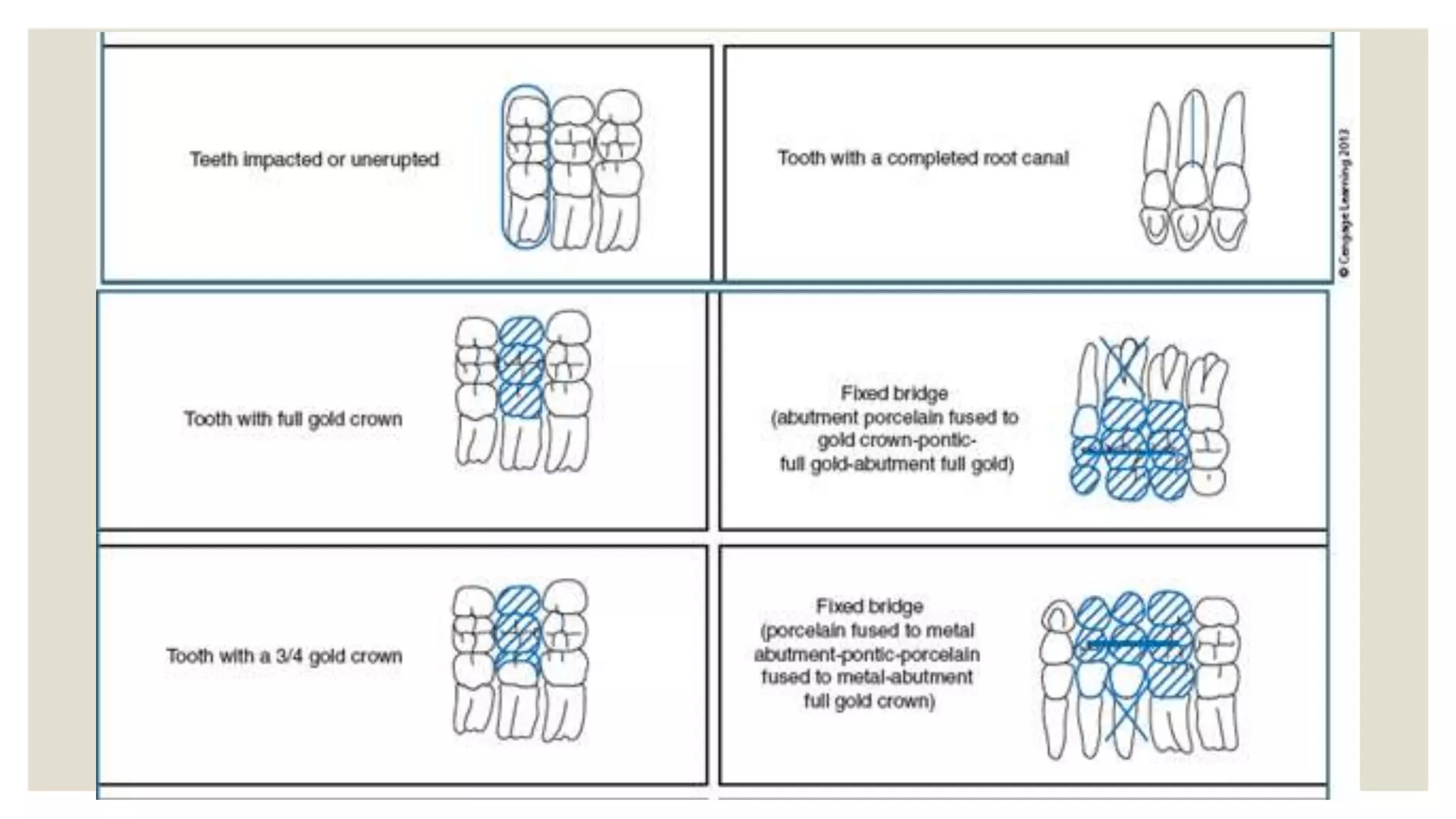 Dental Charting Color Coding And Symbols Class Activity Pptx