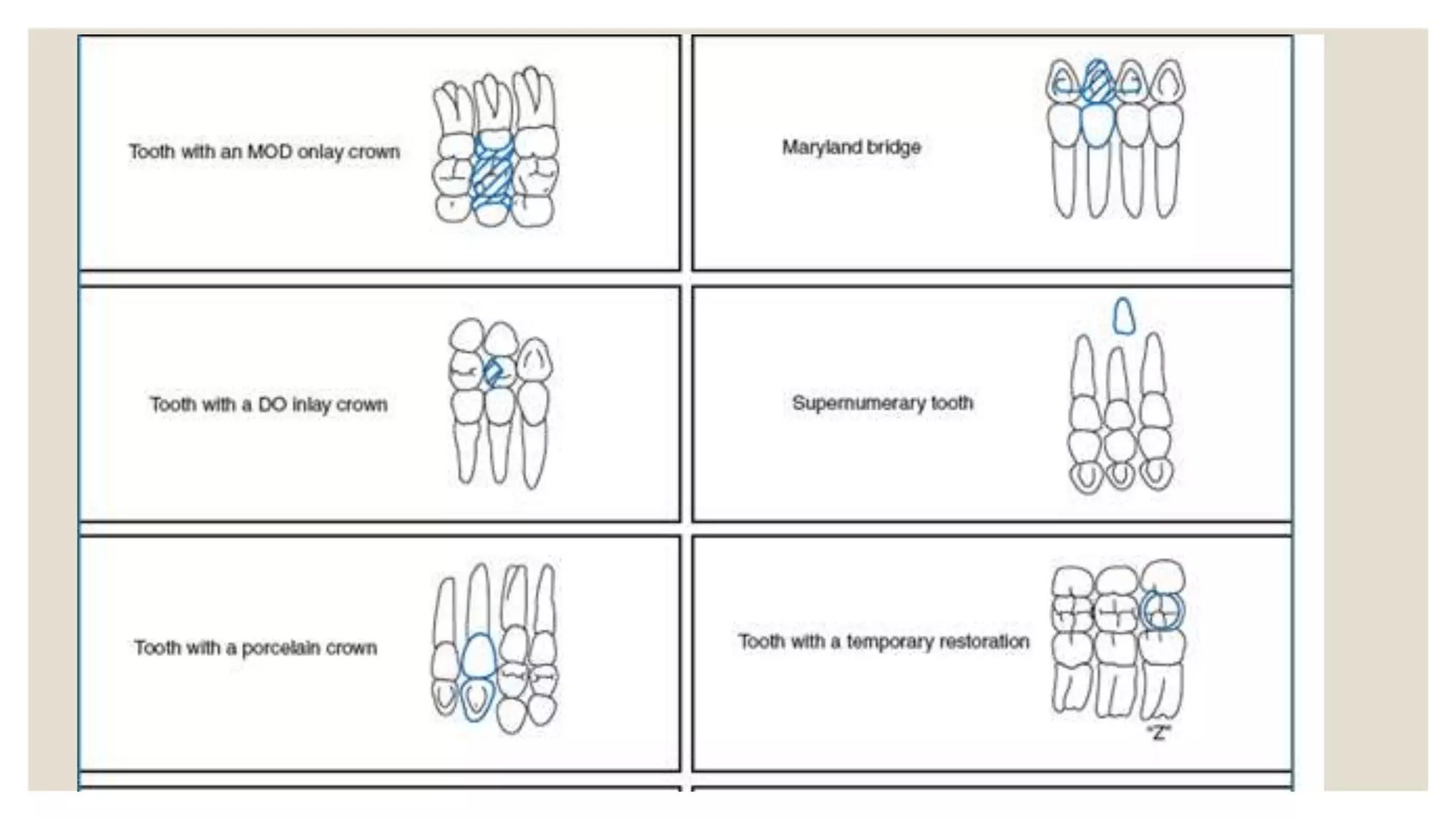 Dental Charting Color Coding And Symbols Class Activity Pptx