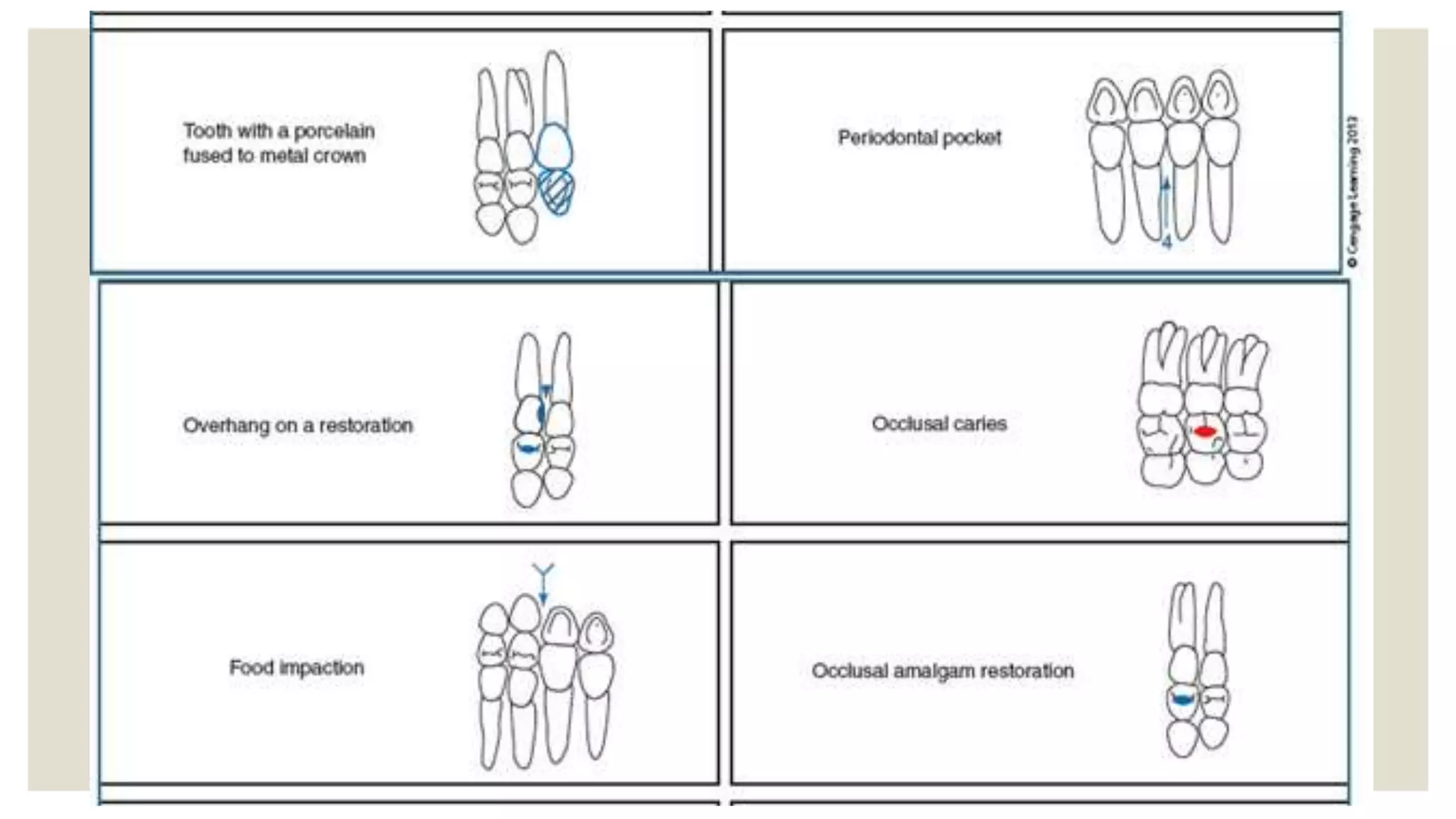 Dental Charting Color Coding And Symbols Class Activity Pptx