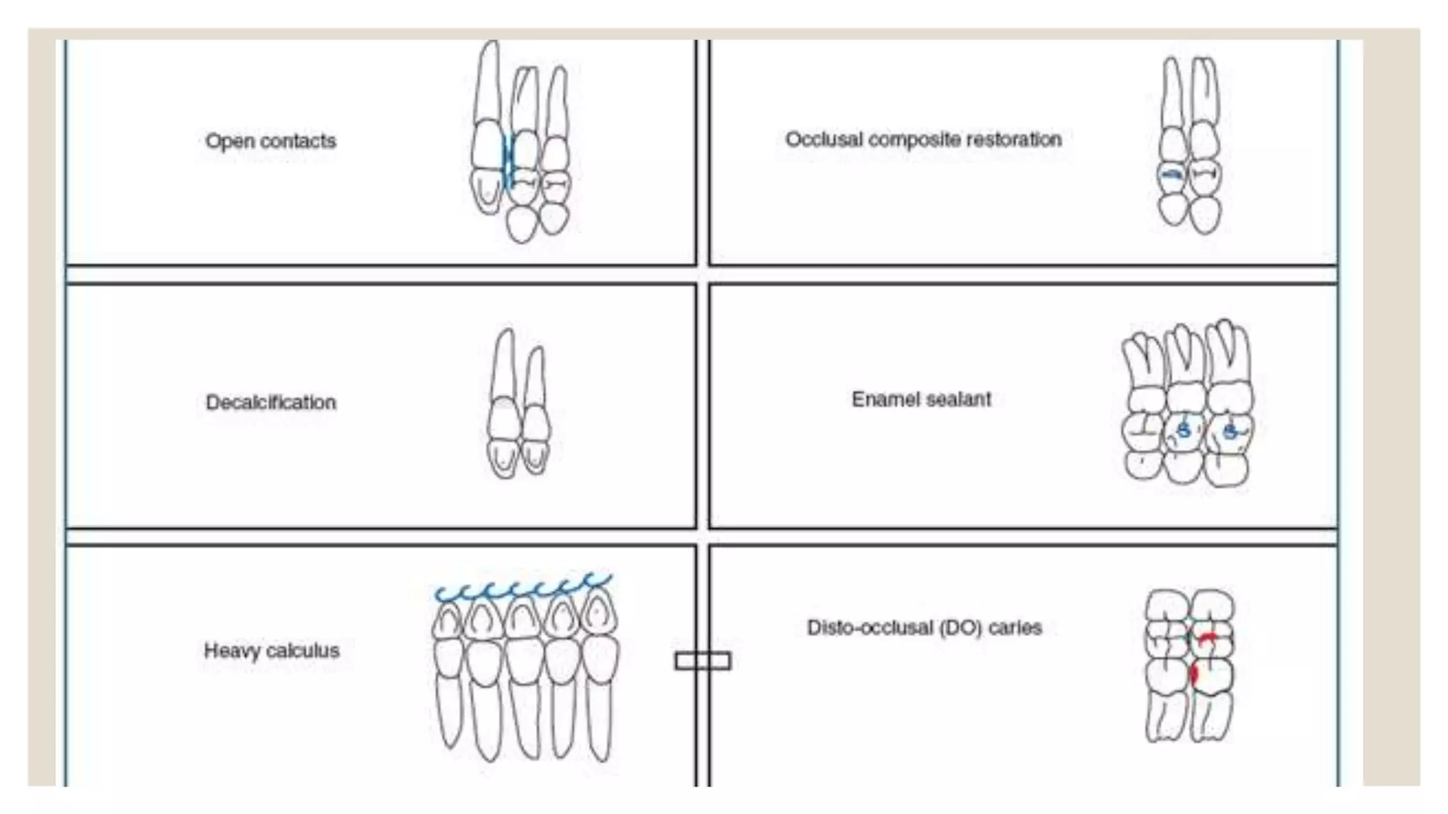 Dental Charting Color Coding And Symbols Class Activity Pptx