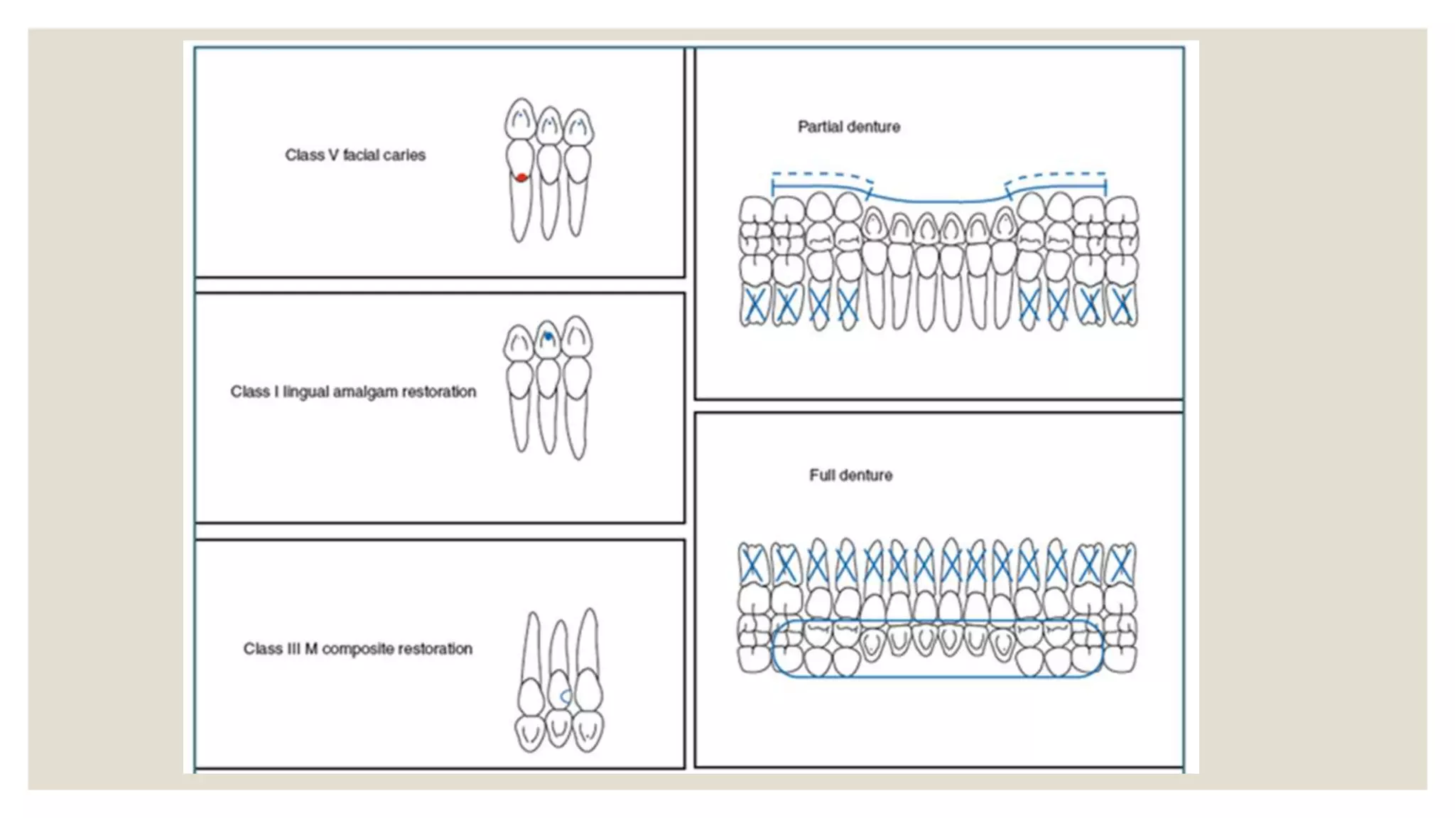 Dental Charting, Color Coding and Symbols: Class Activity | PPTX