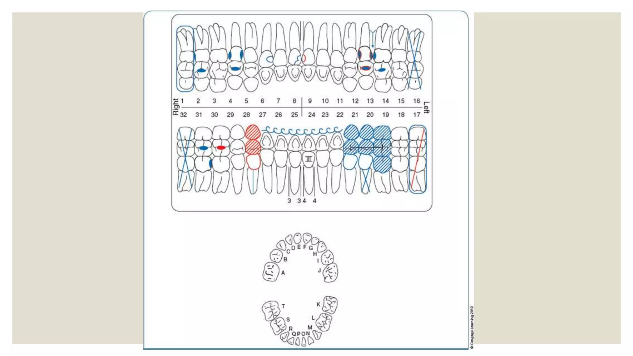 Dental Charting Color Coding And Symbols Class Activity Pptx Dental Health Diseases And