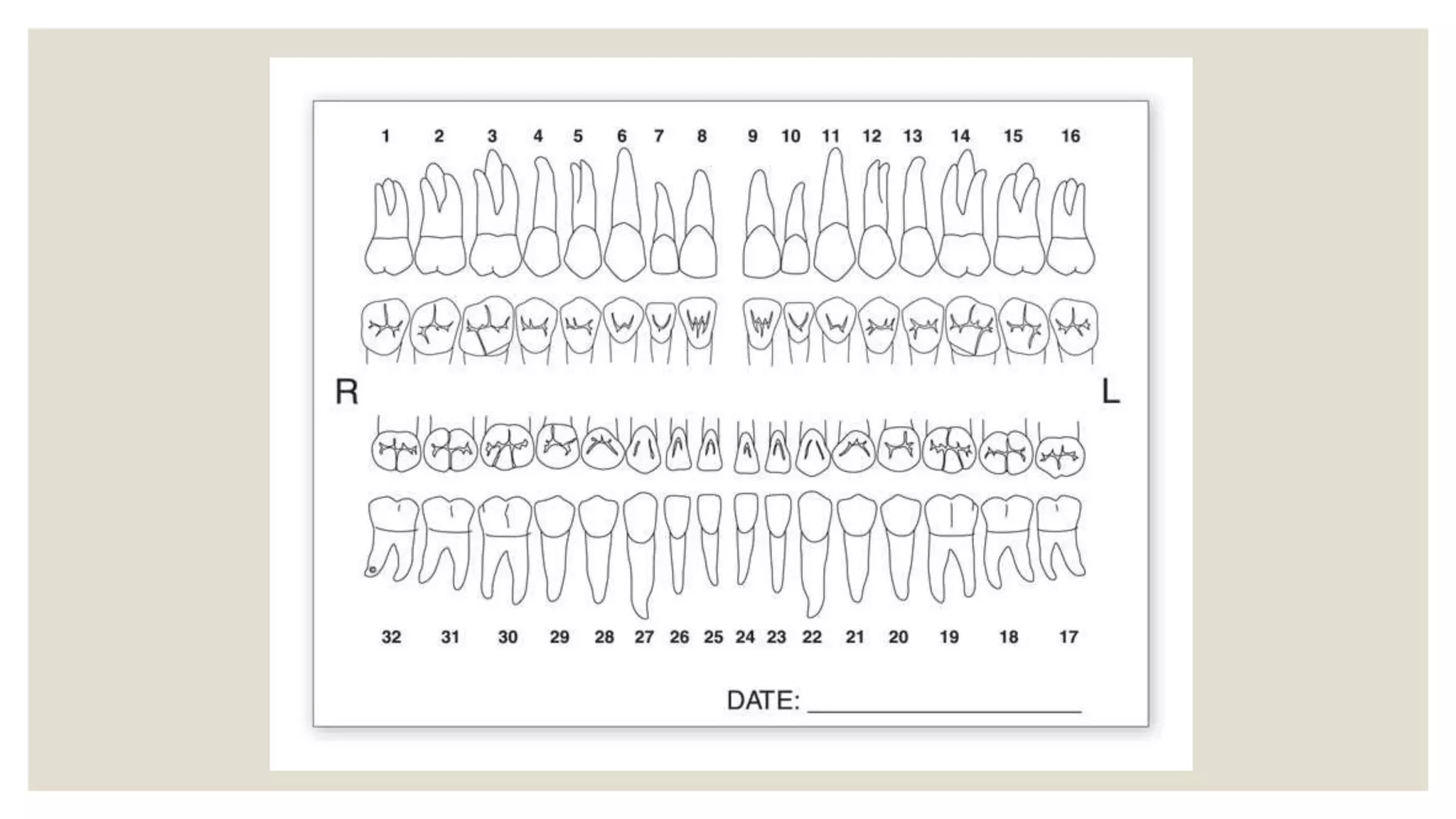 Dental Charting, Color Coding and Symbols: Class Activity | PPTX ...