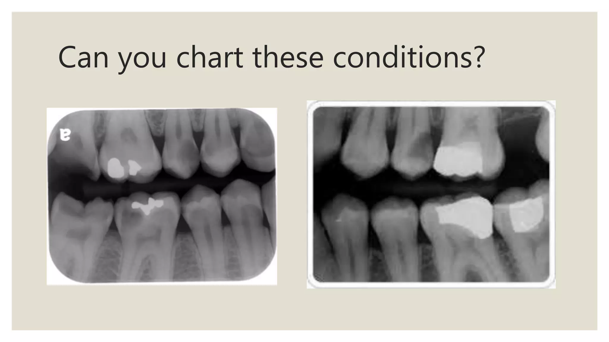 Dental Charting, Color Coding and Symbols: Class Activity | PPTX