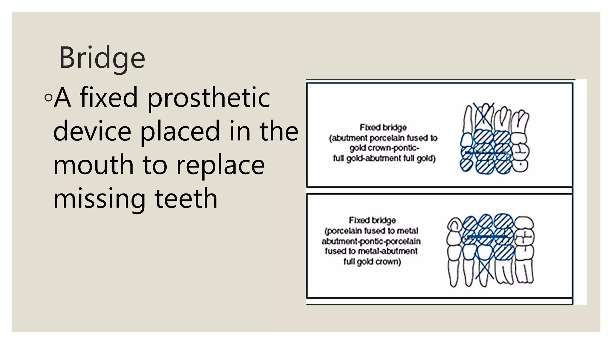 Dental Charting Color Coding And Symbols Class Activity Pptx Dental Health Diseases And