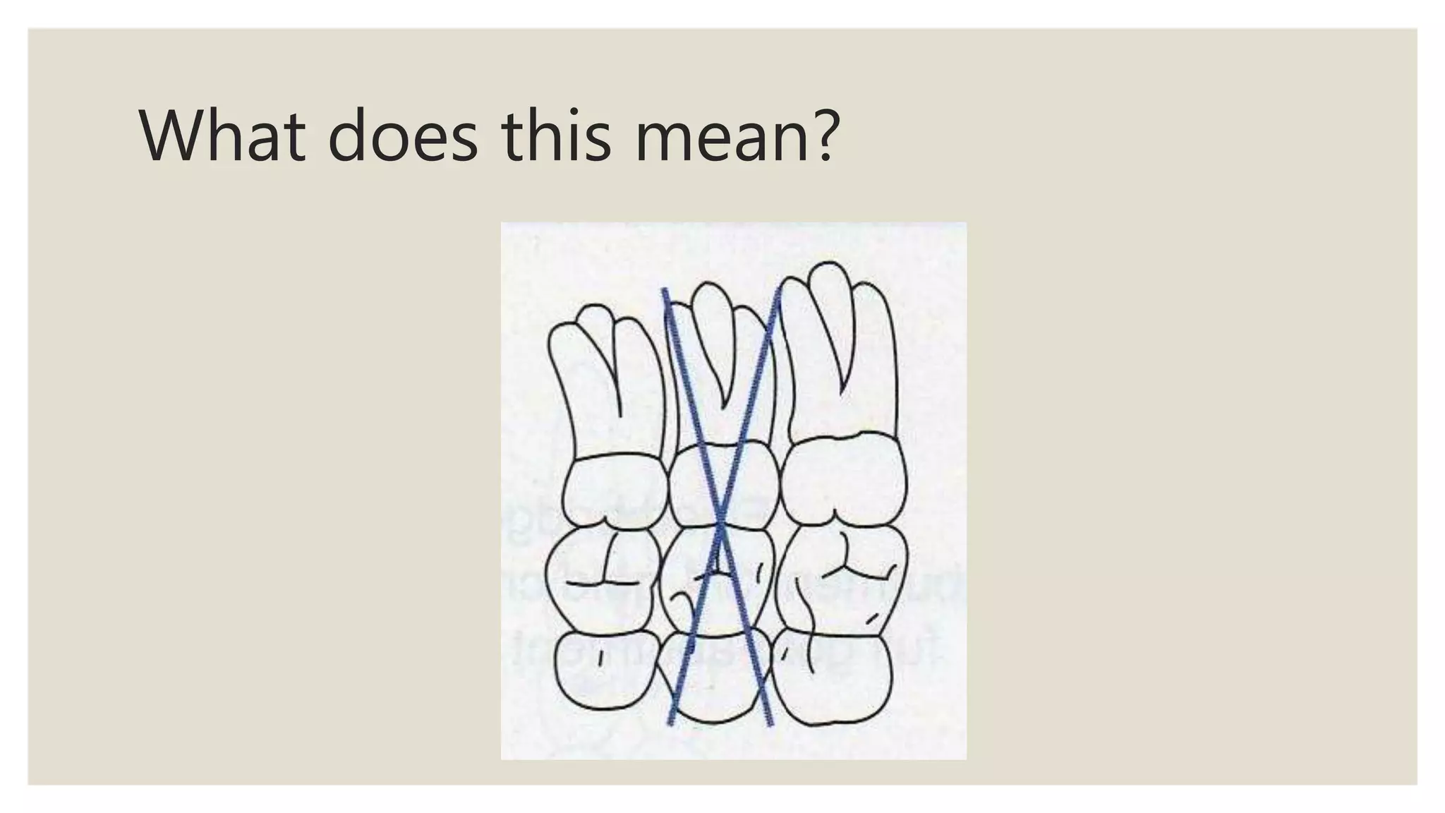 Dental Charting, Color Coding and Symbols: Class Activity | PPTX