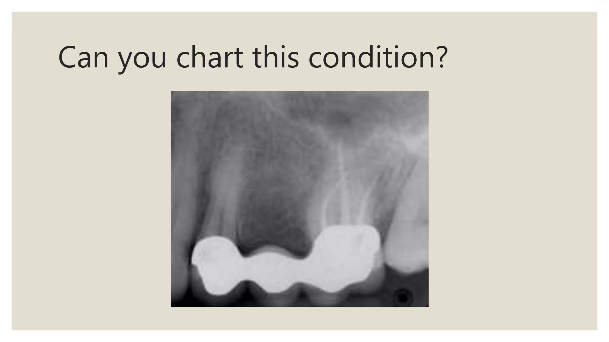 Dental Charting, Color Coding and Symbols: Class Activity | PPTX ...