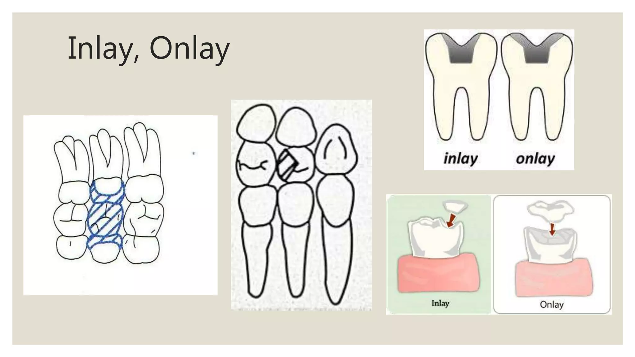 Dental Charting Color Coding And Symbols Class Activity Pptx Dental Health Diseases And