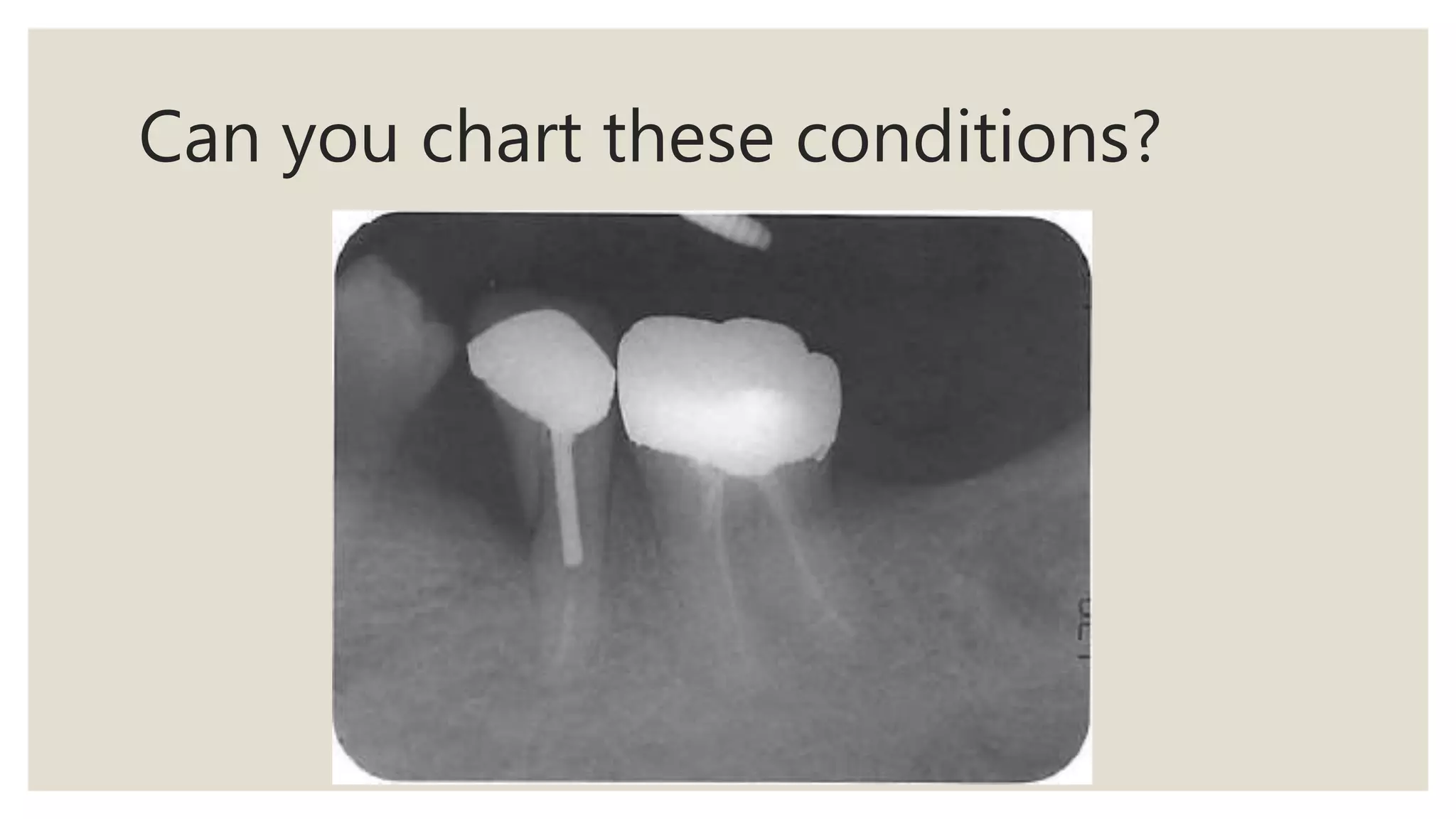Dental Charting, Color Coding and Symbols: Class Activity | PPTX ...