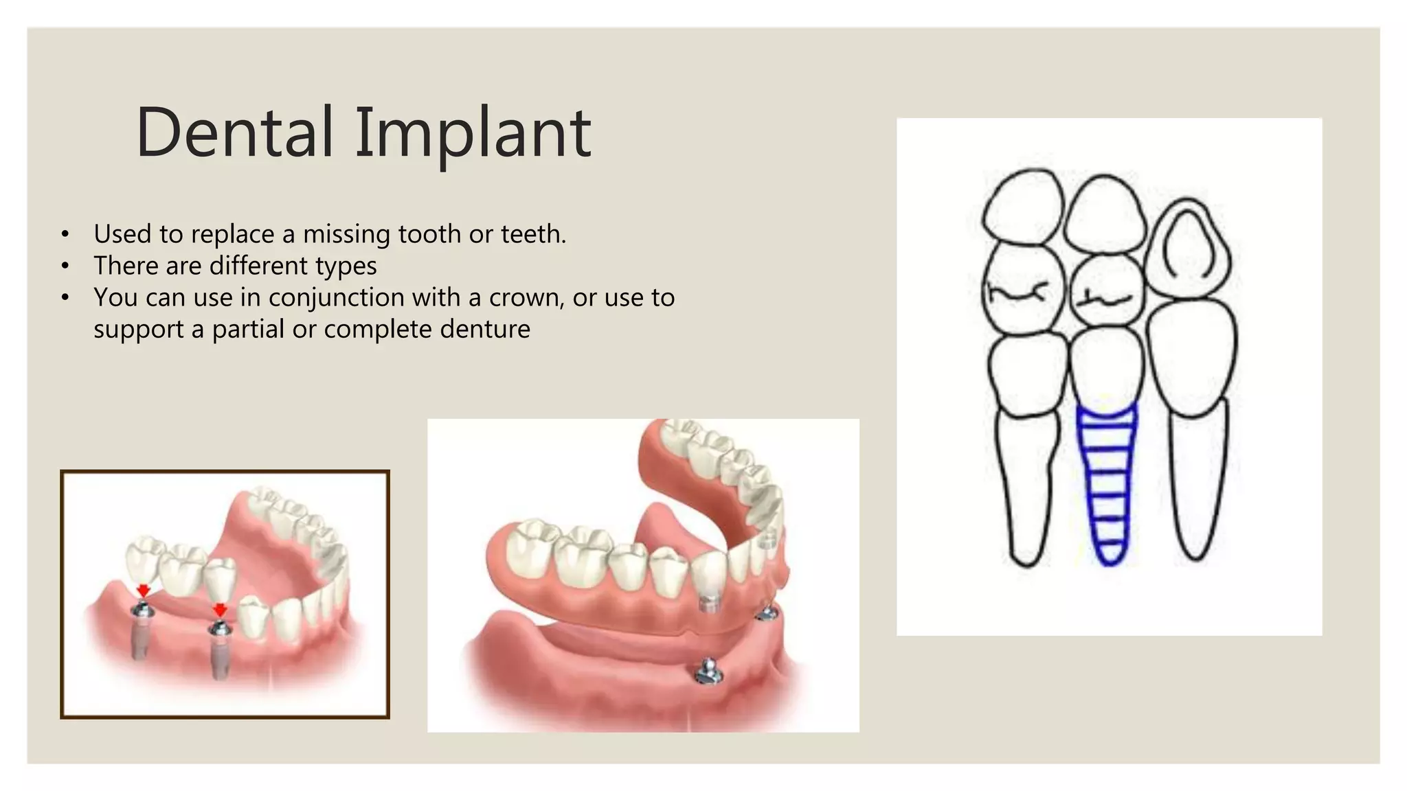 Dental Charting, Color Coding and Symbols: Class Activity | PPTX