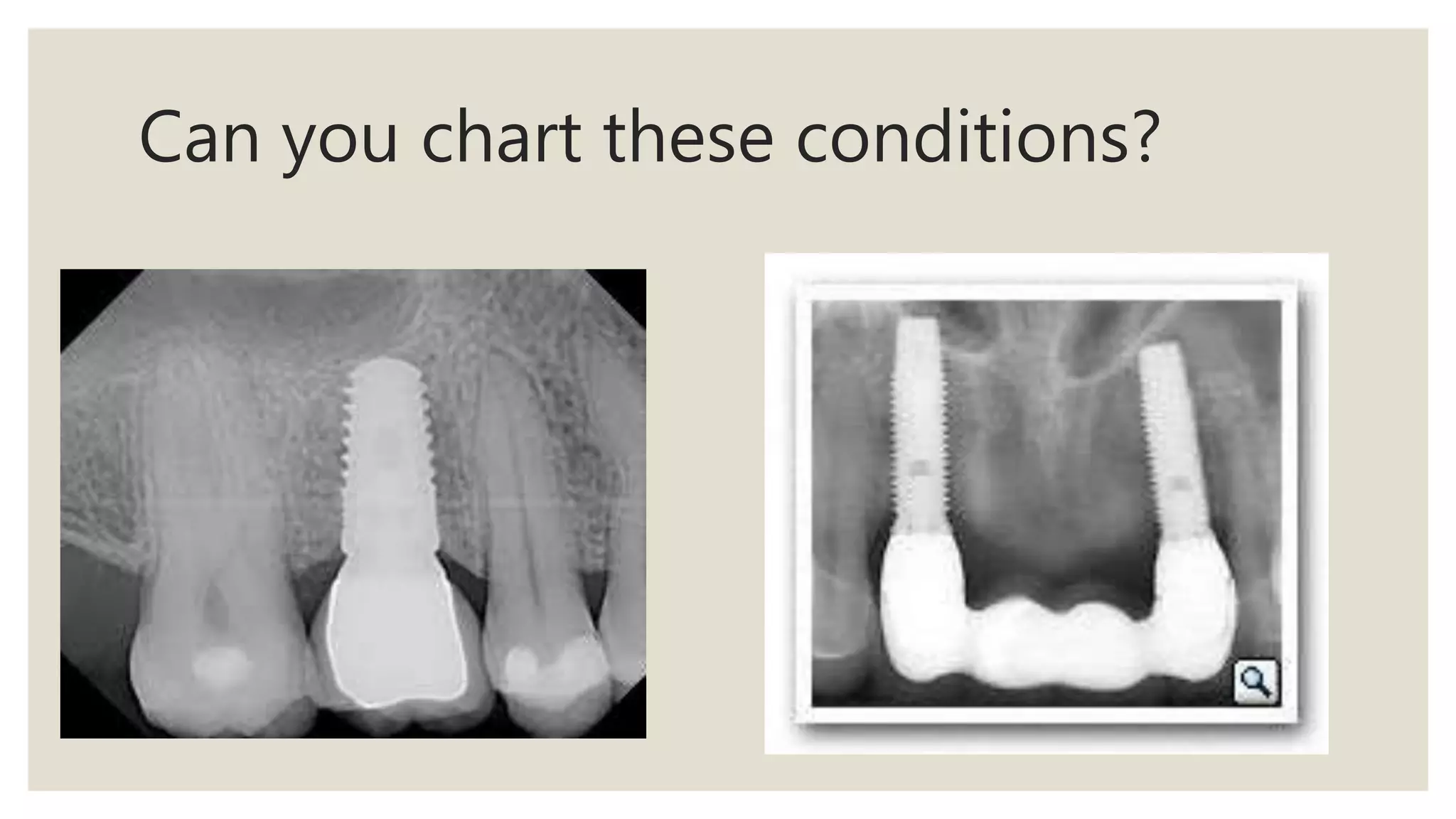 Dental Charting Color Coding And Symbols Class Activity Pptx Dental Health Diseases And