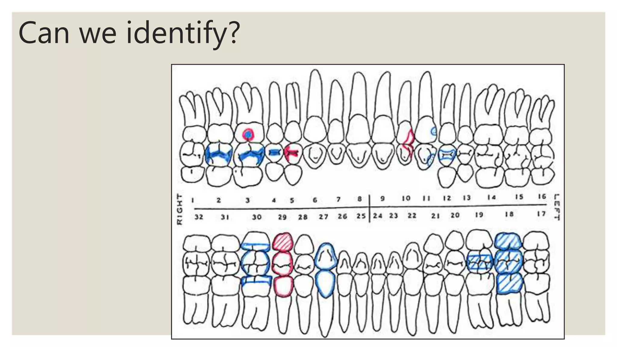 Dental Charting, Color Coding and Symbols: Class Activity | PPTX