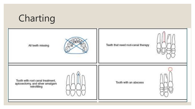 Dental Charting, Color Coding and Symbols: Class Activity | PPTX ...