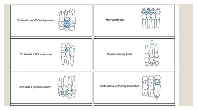 Dental Charting, Color Coding and Symbols: Class Activity | PPTX ...