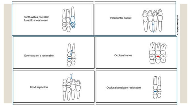 Dental Charting, Color Coding and Symbols: Class Activity | PPTX ...