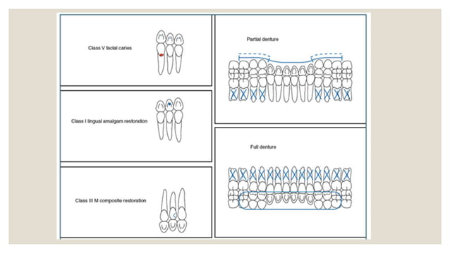 Dental Charting, Color Coding and Symbols: Class Activity | PPTX ...