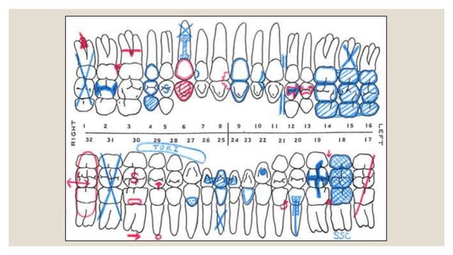 Dental Charting, Color Coding and Symbols: Class Activity | PPTX ...