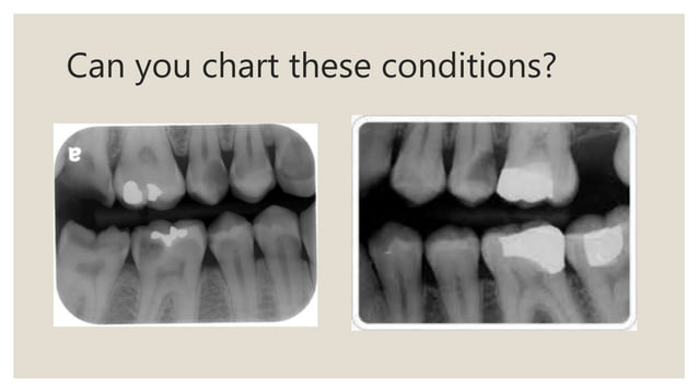 Dental Charting, Color Coding and Symbols: Class Activity | PPTX ...