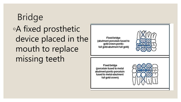 Dental Charting, Color Coding and Symbols: Class Activity | PPTX ...