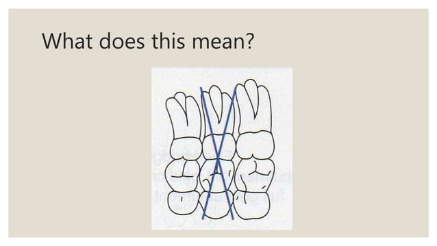Dental Charting, Color Coding and Symbols: Class Activity | PPTX ...