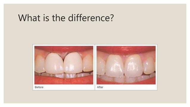 Dental Charting, Color Coding and Symbols: Class Activity | PPTX ...