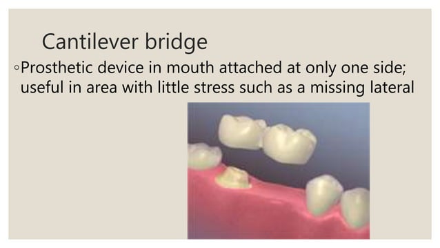 Dental Charting, Color Coding and Symbols: Class Activity | PPTX ...