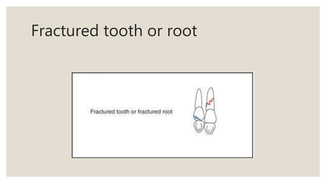 Dental Charting, Color Coding and Symbols: Class Activity | PPTX ...