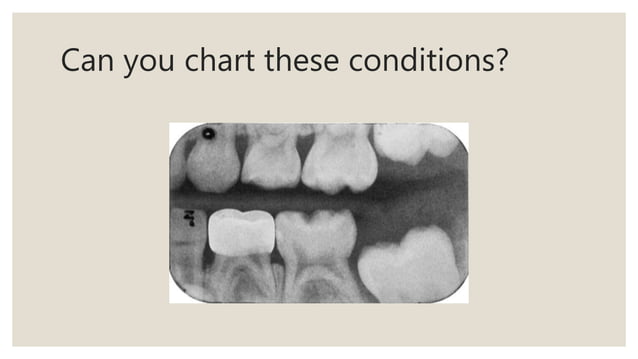 Dental Charting, Color Coding and Symbols: Class Activity | PPTX ...