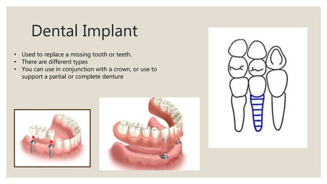 Dental Charting, Color Coding and Symbols: Class Activity | PPTX ...