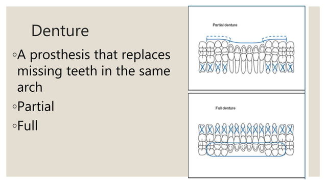 Dental Charting, Color Coding and Symbols: Class Activity | PPTX ...