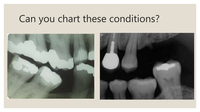 Dental Charting, Color Coding and Symbols: Class Activity | PPTX ...