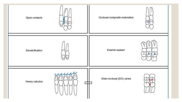 Dental Charting, Color Coding and Symbols: Class Activity | PPT