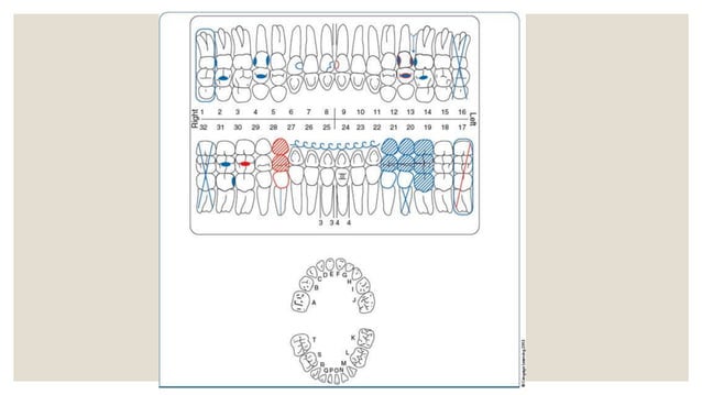 Dental Charting, Color Coding and Symbols: Class Activity | PPT