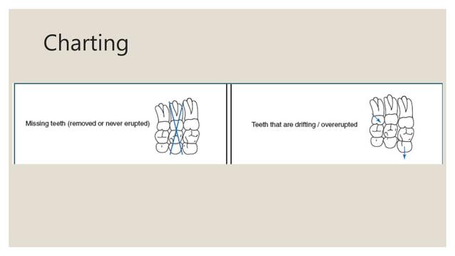 Dental Charting, Color Coding and Symbols: Class Activity | PPT