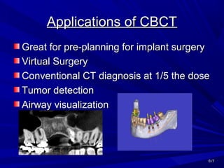 Dental conebeamct | PPT