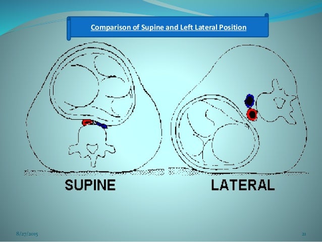 Dental considerations in pregnant women