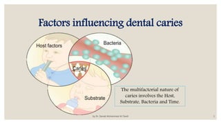 Dental cries | PPTX