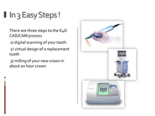 Dental crown in an hour | PPT