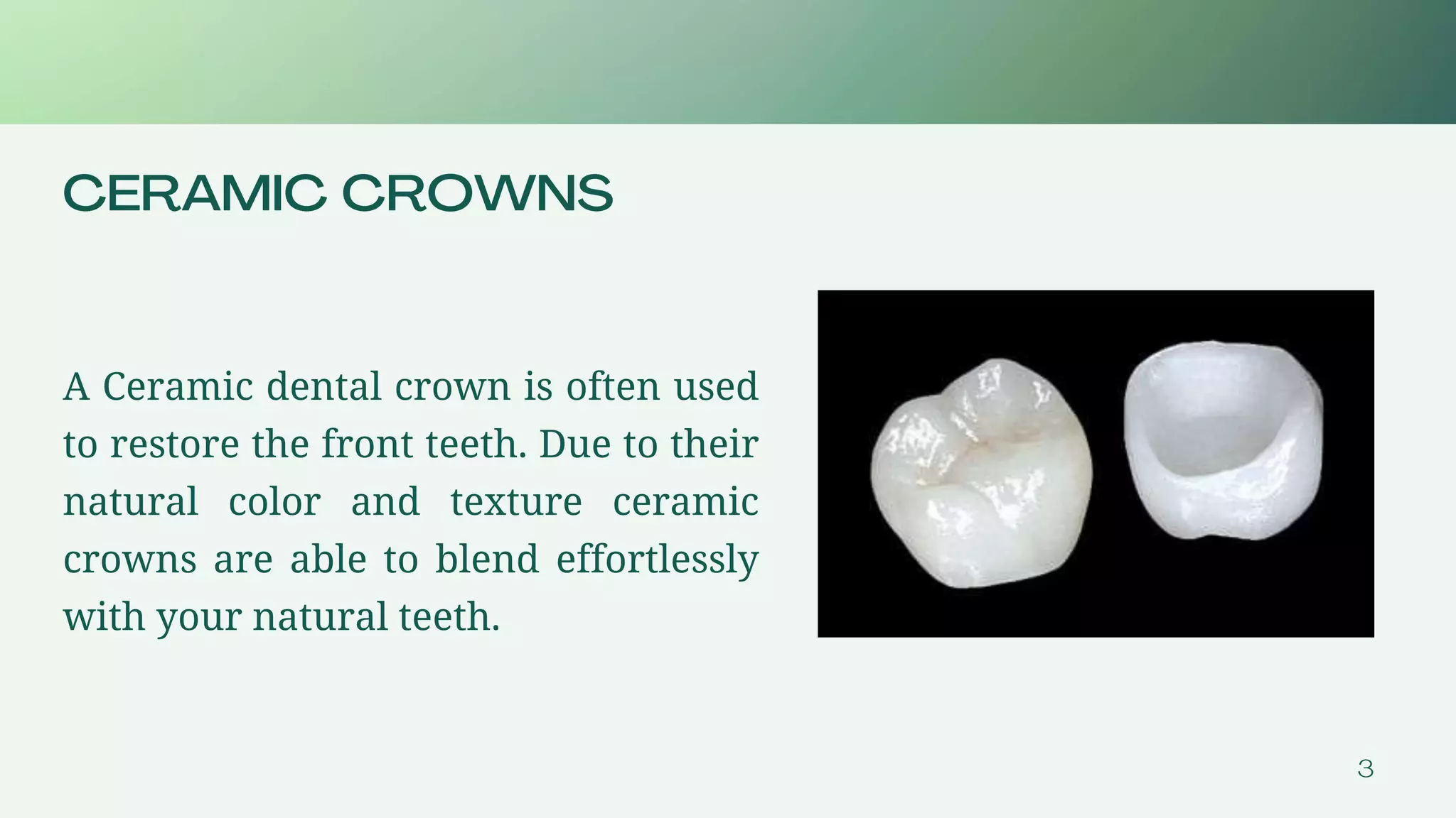 Dental Crowns .pptx