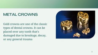 Dental Crowns .pptx