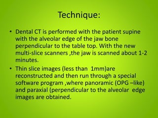 Dental ct imaging Srinivas rao | PPTX