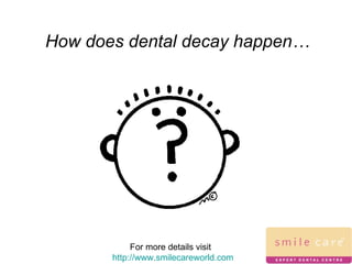 Dental decay and ways to prevent it | PPT